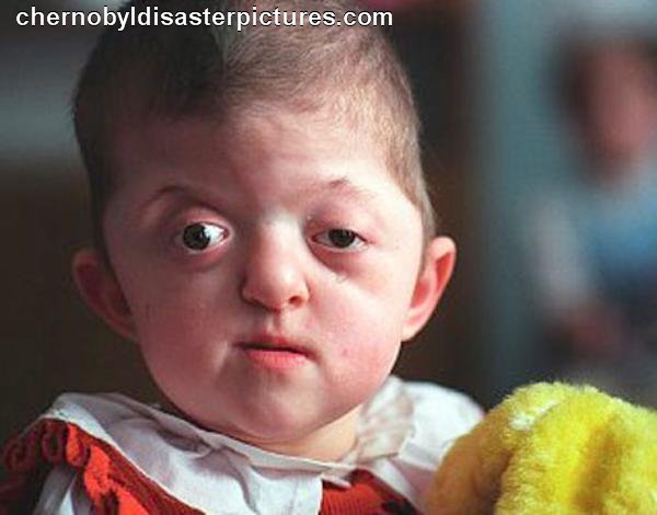 A Psychotic Wanderer's Musings: Chernobyl Aftermath